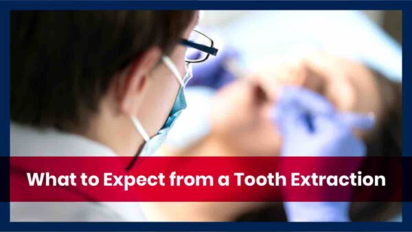 What to Expect from a Tooth Extraction | USHEALTH Group